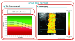 EWBC adds Trabecular Bone Score (TBS) with Bone Density Testing ...